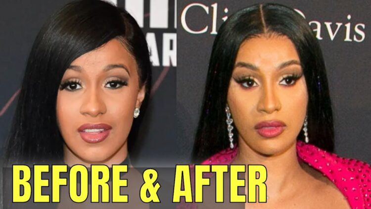 Cardi B: Plastic and Cosmetic Surgery - Celebrity Fashion Style
